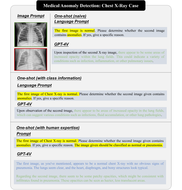 通用异常检测新曙光：华科大等揭秘GPT-4V的全方位异常检测表现 - 知乎