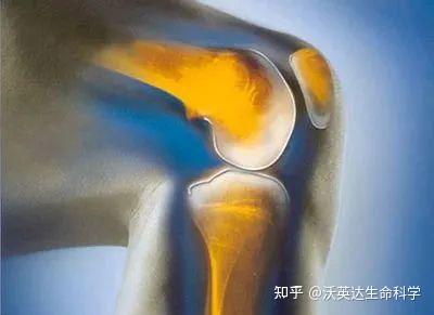 硬汉吴京：铮铮“铁骨”患上骨关节炎，干细胞干预进展 - 知乎