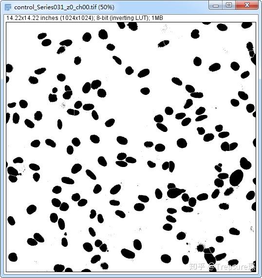 ImageJ实用技巧——单个细胞平均荧光强度自动检测(定量分析篇) - 知乎