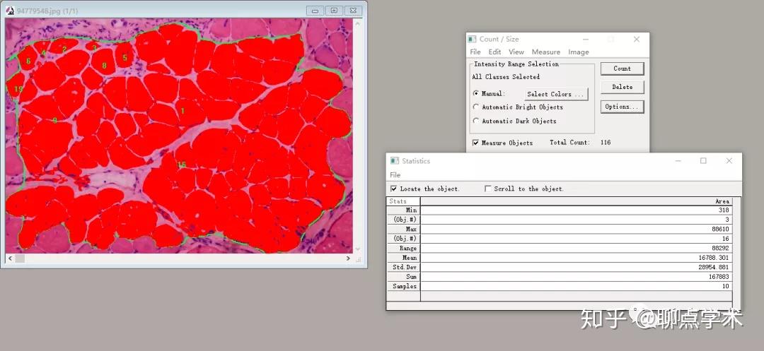 首创！IPP（Image-Pro Plus）精准测量肌纤维直径的方法讲解 - 知乎