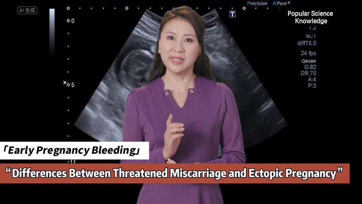 Early Pregnancy Bleeding: Distinguishing Between Threatened Miscarriage ...