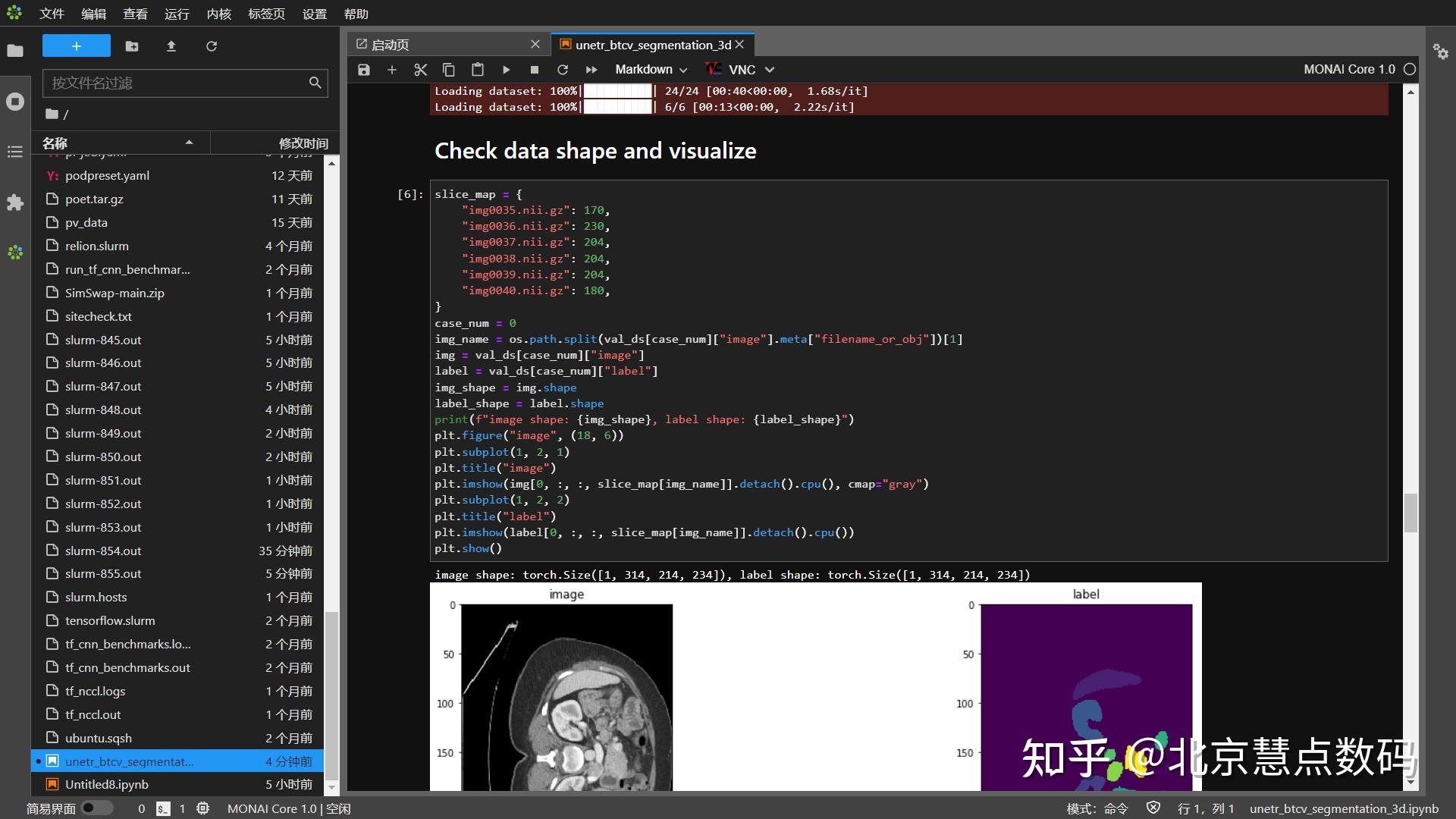在慧点数码hpc平台上运行 Project Monai 示例 知乎