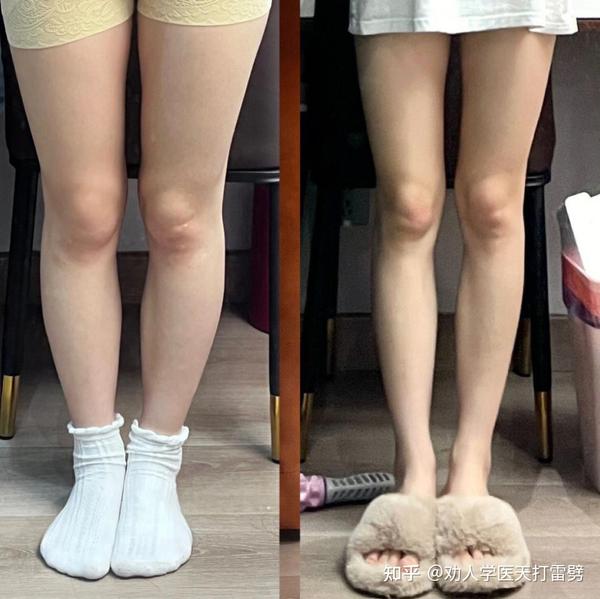 瘦腿霜是真的有效还是智商税?!如何在两个月内快速瘦腿? 知乎