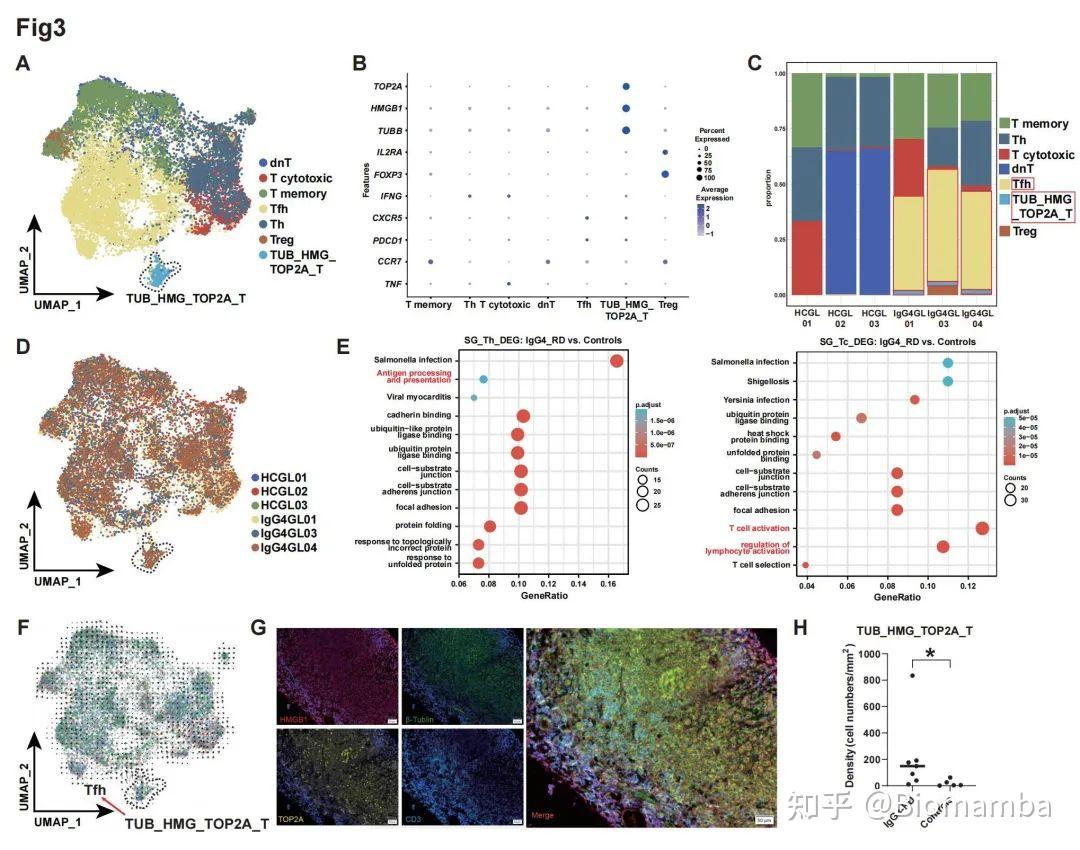 IgG4相关性疾病中颌下腺和血液中的细胞和分子改变 - 知乎