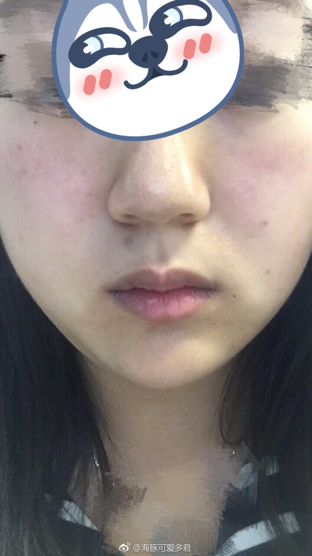 日常生活中你有哪些能让皮肤变好的小习惯 知乎