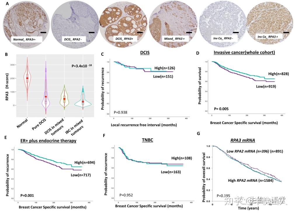 7.5分1区SCI，基因集单肿瘤分析+实验，自有样本结合公共数据库的研究典范 - 知乎