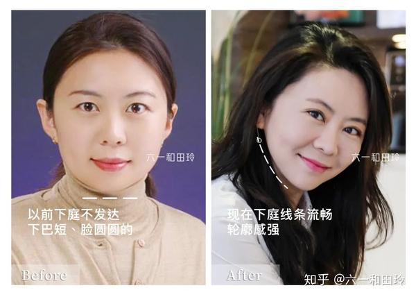 怎样快速摆脱土气感？这个部位是关键。 知乎