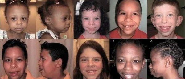 [眼动文章] 人不可貌相？威廉姆斯综合征患者基于面孔线索的信任评估 - 知乎