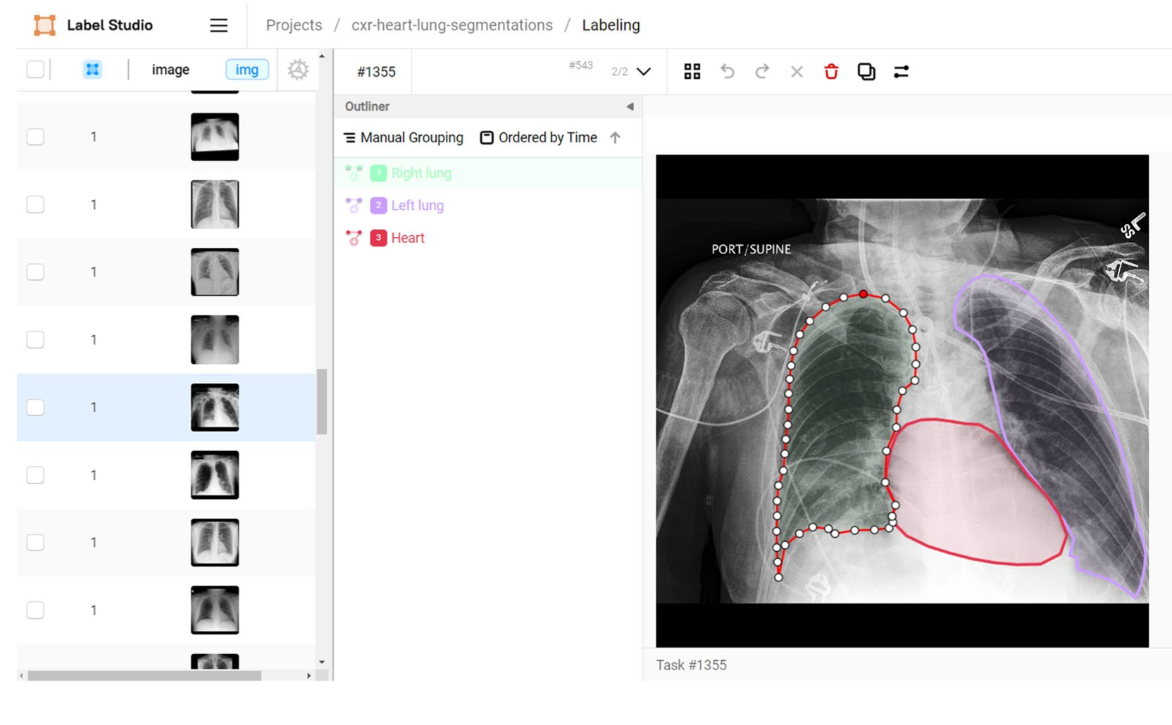 CheXmask Database 数据集介绍 - 知乎