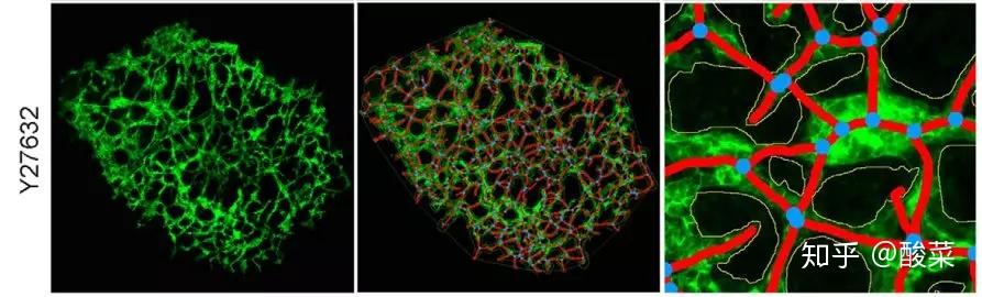 如何用ImageJ进行血管分析？ - 知乎