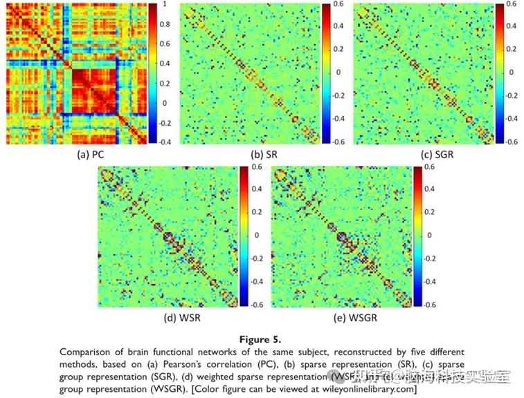 Hum Brain Mapp：基于连接强度加权稀疏群表示的脑网络构建新方法可用于轻度认知障碍分类 - 知乎