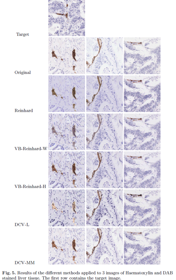 Colour Normalisation in Digital Histopathology Img - 知乎