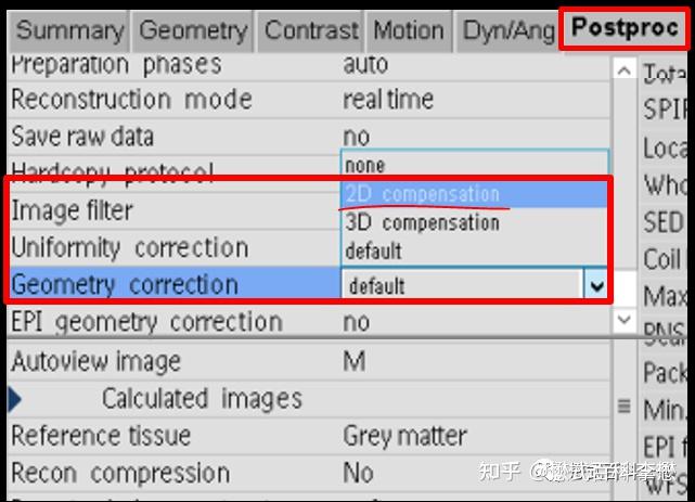 消除EPI几何形变技术——EPIC - 知乎
