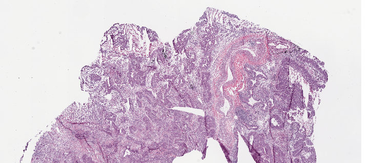 深度学习——WSI方向的数据收集 - 知乎