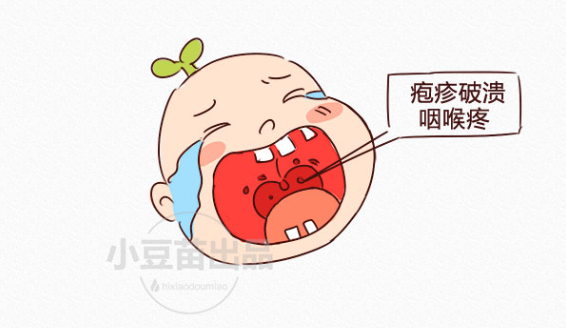 10问“EV71疫苗”，预防手足口宜早不宜晚！ - 知乎