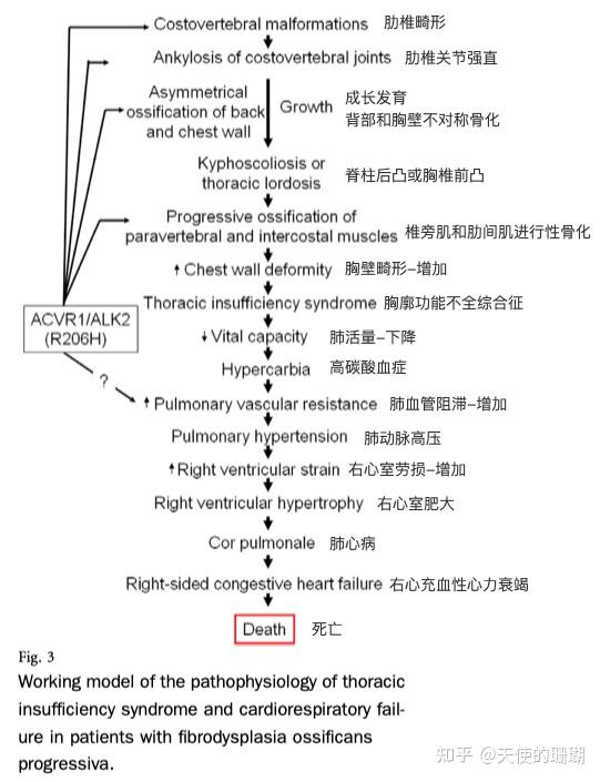 FOP患者的早期死亡率和心肺功能衰竭 - 知乎