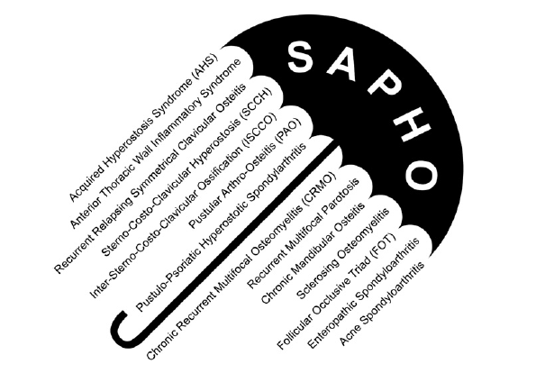 研究SAPHO患者骶髂关节病变MRI表现的目的！ - 知乎