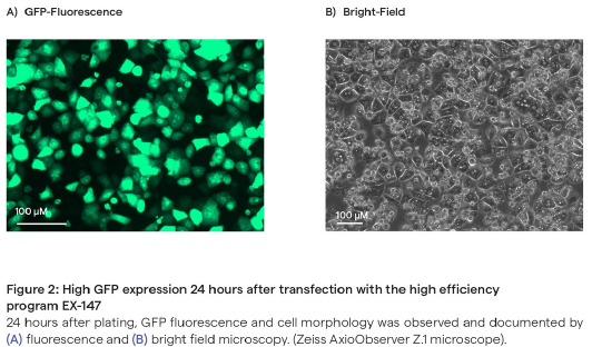 肝细胞高效转染和长期持续功能的帮手：Lonza 电转穿越传统难关！ - 知乎