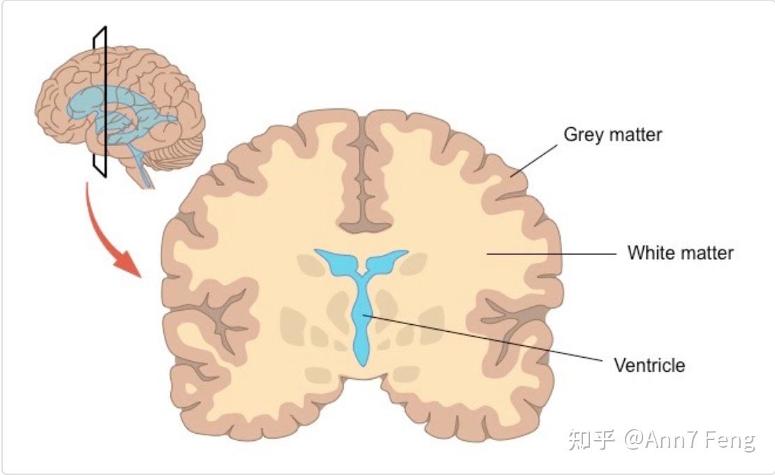 【Medical Imaging 01】 Diffusion Tensor Imaging (DTI) - 知乎
