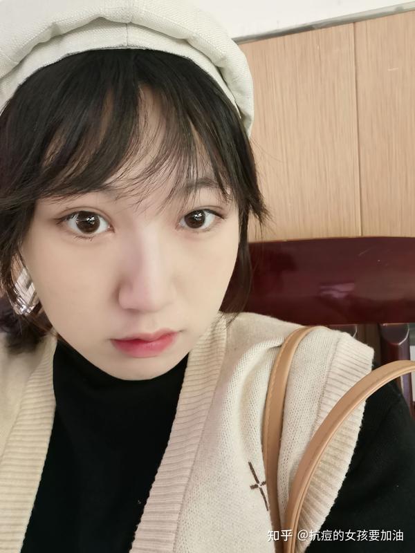 痘痘女孩的臭美自拍 知乎