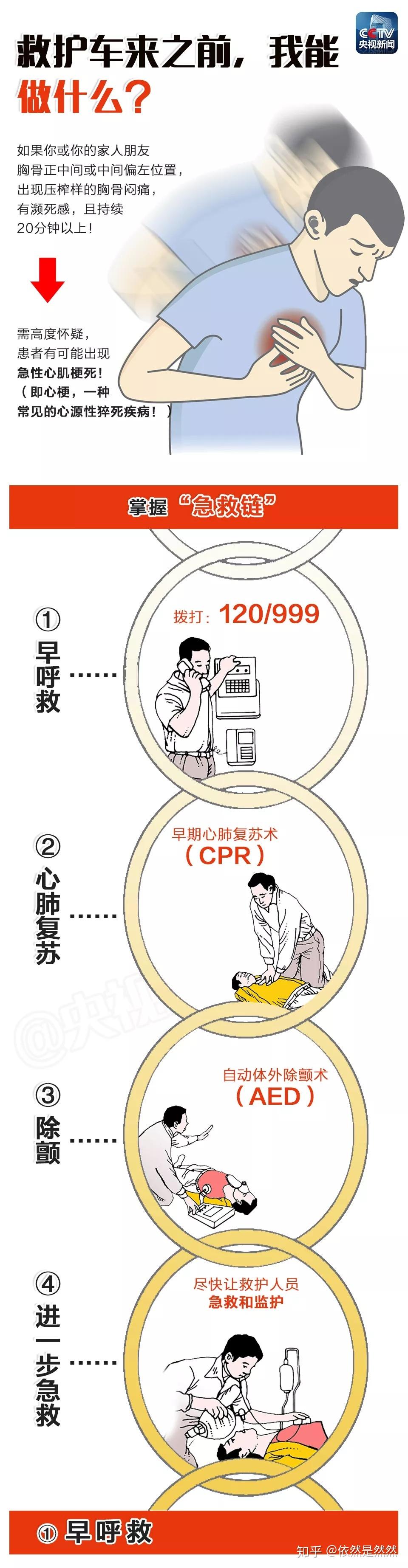 猝死急救 - 知乎