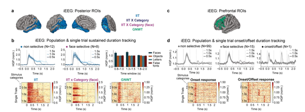 IIT vs GNWT：意识理论对比检验 - 知乎