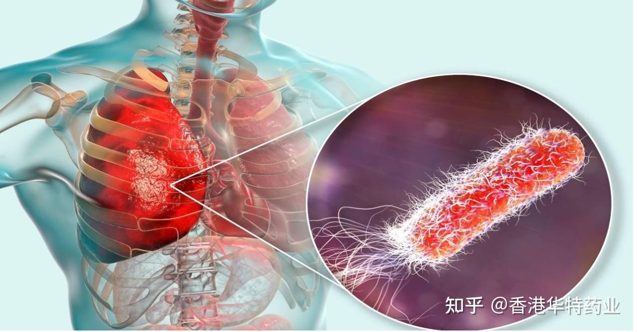 头孢地洛（Fetroja cefiderocol）适用于治疗易患复杂性尿路感染 (cUTI) - 知乎
