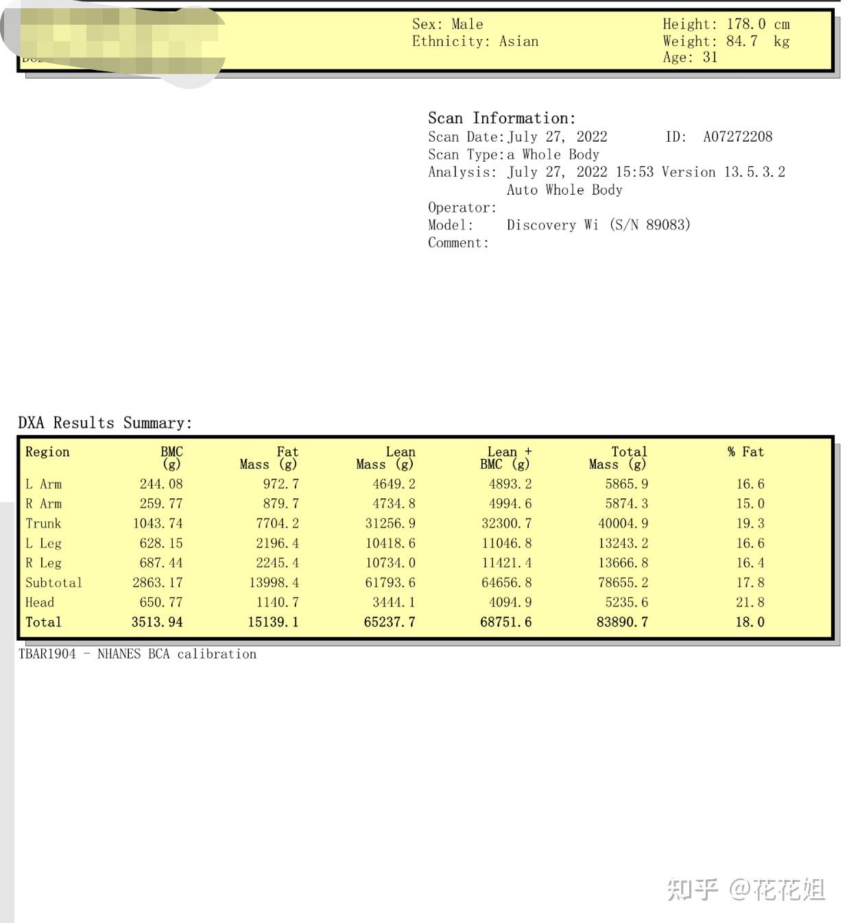 哪里可以测DXA，看自己的身体身份？ - 知乎