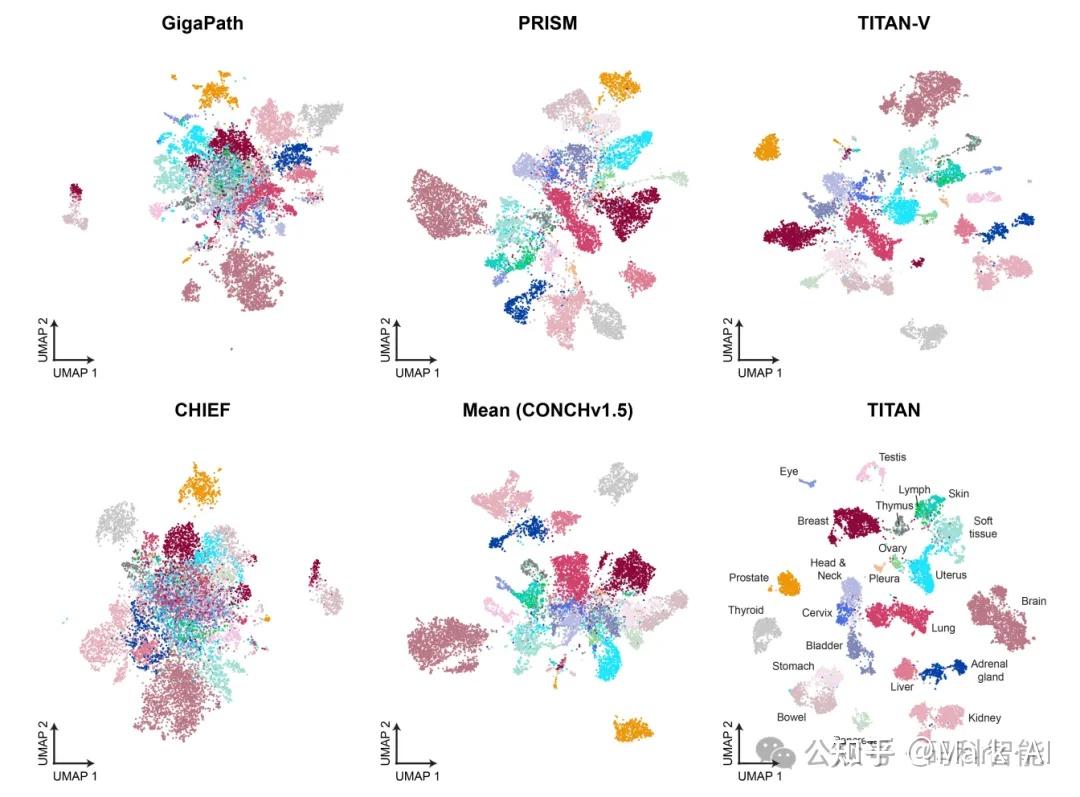 病理大模型四重奏，哈佛医学院全部开源！从UNI、CHIEF到TITAN，从诊断疾病到生成报告，适用30+癌症类型 - 知乎