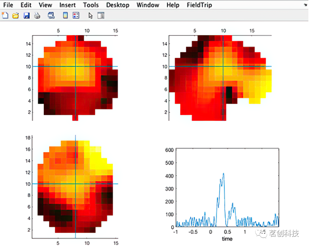 代码分享 | EEG数据的等效偶极子源定位 - 知乎