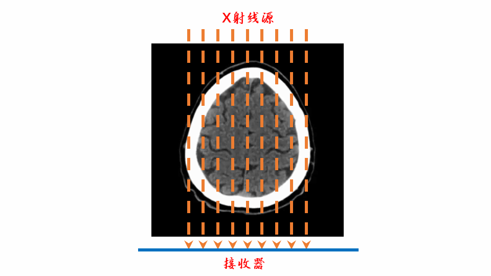 浅谈CT 扫描成像原理 - 知乎