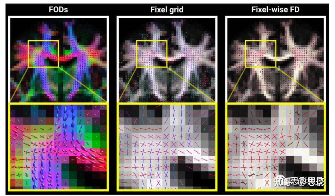 基于扩散磁共振成像的FBA（Fixel-Based Analysis）分析 - 知乎