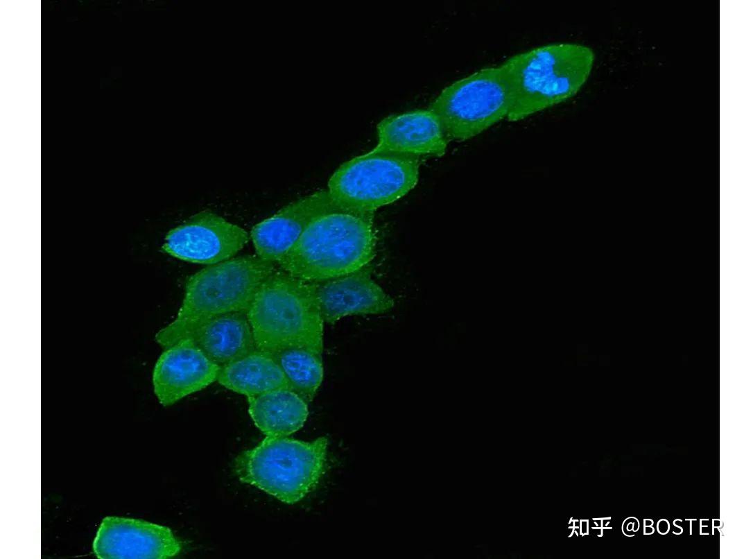 细胞器标记物蛋白的免疫组化/荧光 - 知乎