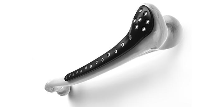 Carbon Reinforced PEEK for Trauma - 知乎