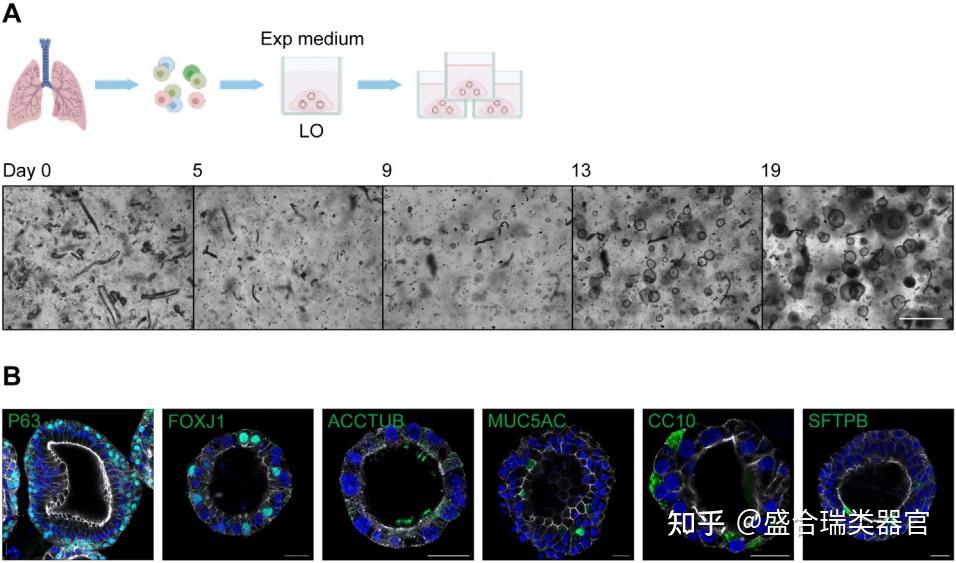 建立双潜能人肺类器官培养系统并分化生成成熟的肺泡和气道类器官 - 知乎