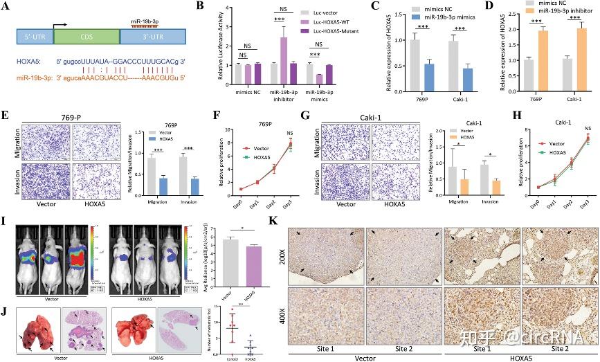 circRNA可发挥分子海绵作用，可用于诊断和治疗肾细胞癌 - 知乎