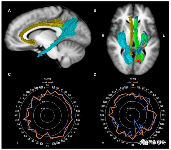 基于约束球面反卷积扩散磁共振的脑白质解剖图谱 - 知乎