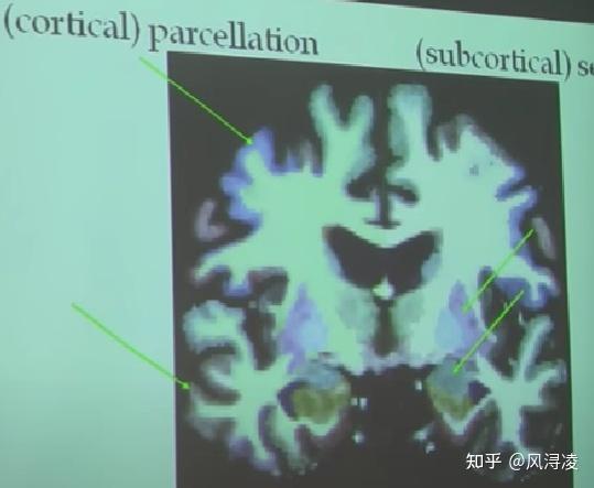 freesurfer下载安装，常用术语和recon-all命令 - 知乎