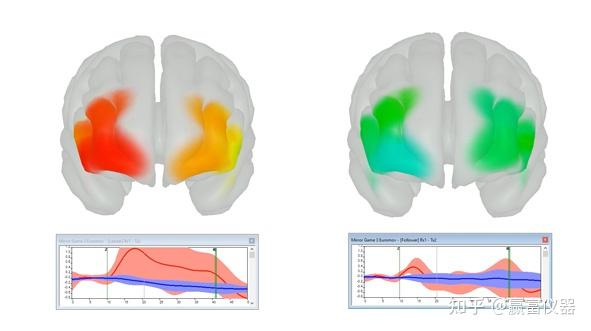 fNIRS在神经科学及新兴领域中的应用 - 知乎