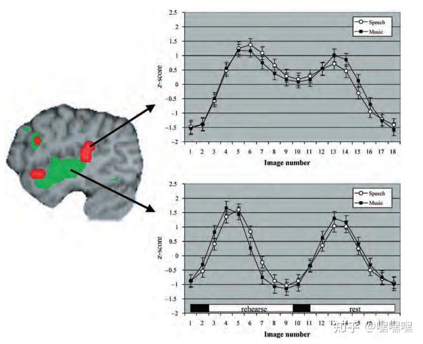 神经语言学笔记（二）：言语感知 Speech Perception - 知乎
