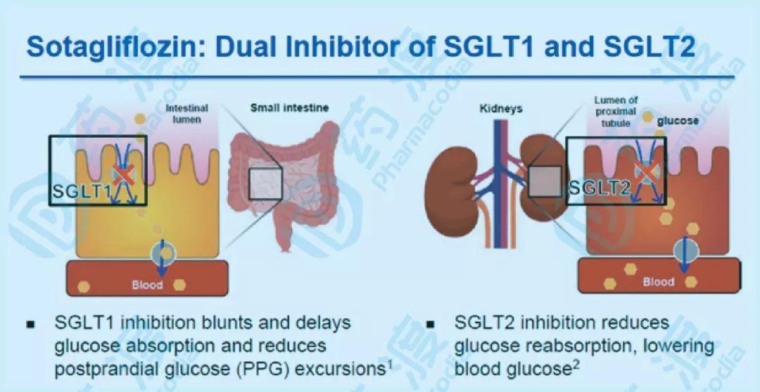 全球糖尿病患者福音!首款SGLT1/SGLT2双效口服降糖药获批上市 - 知乎