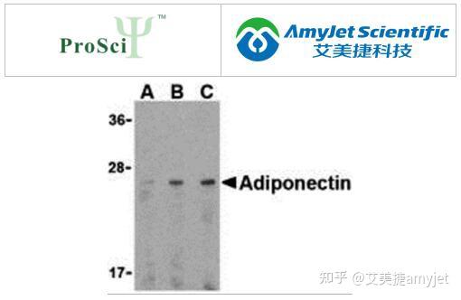 脂肪因子研究：ProSci脂联素和CTRPs 1-7检测套装 - 知乎