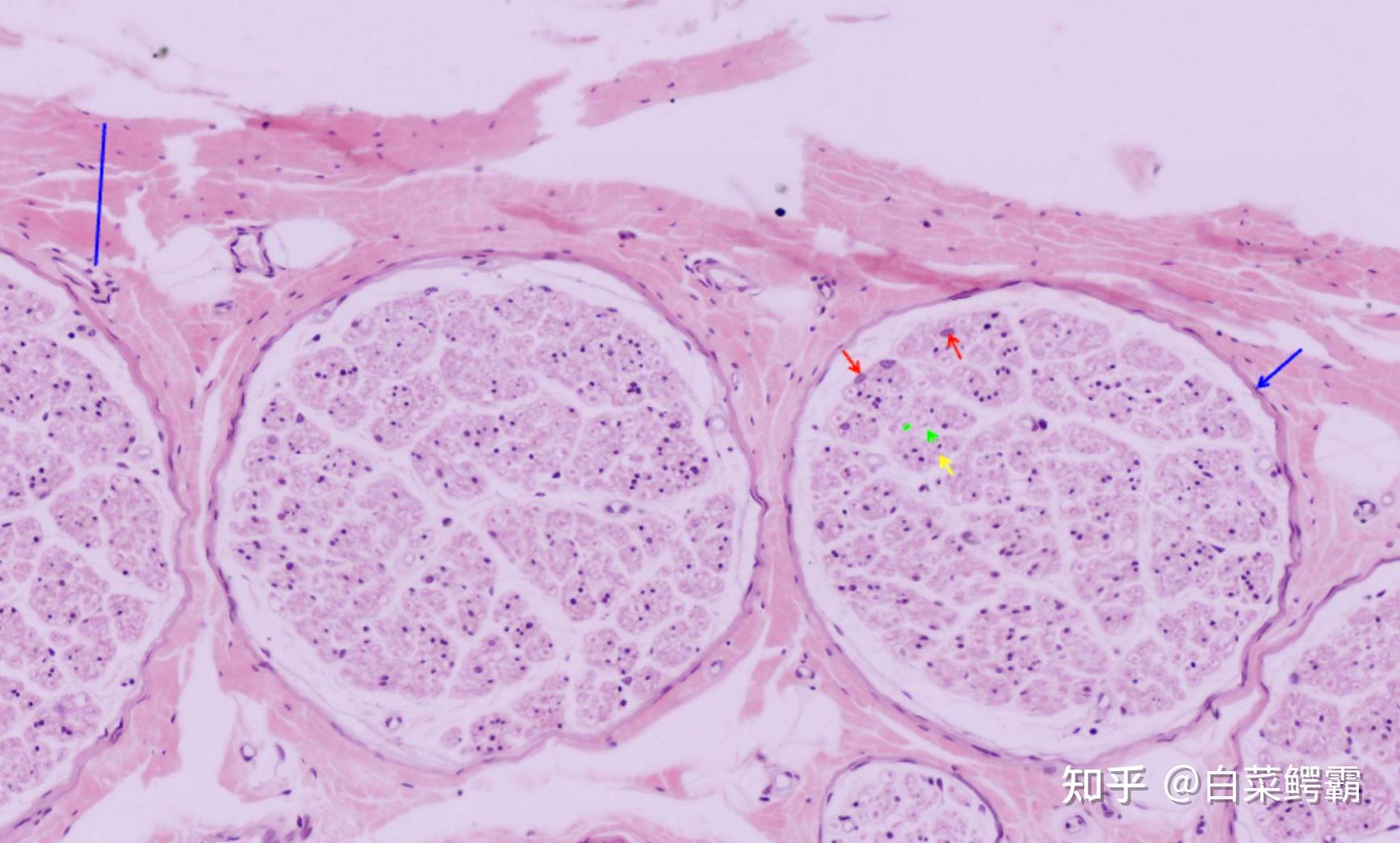 HE染色特征：神经 / Nerve - 知乎
