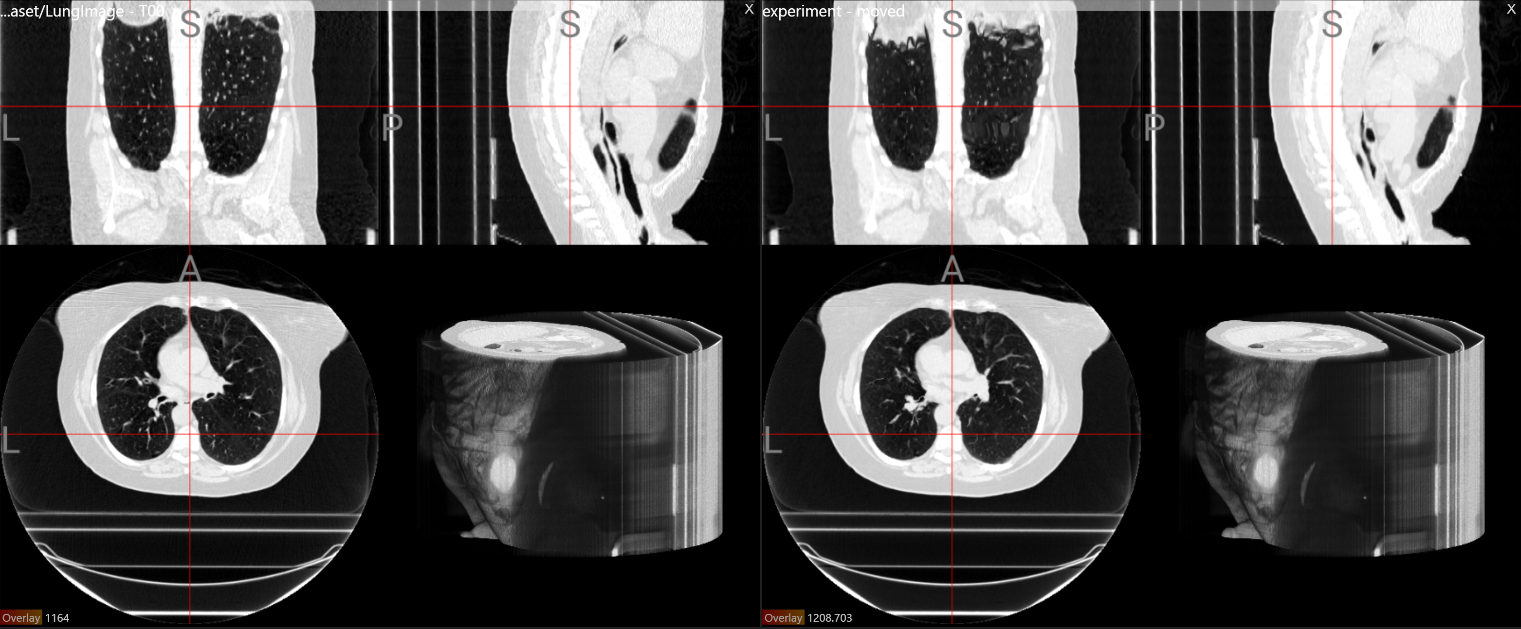 使用 voxelmorph 进行 CT 影像配准——原理和代码实现 - 知乎