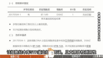 BT-549细胞培养，人乳腺管癌细胞培养攻略 - 知乎