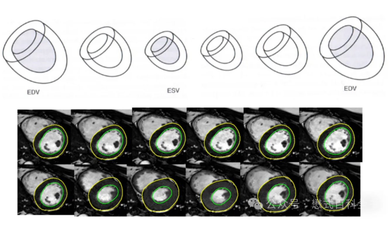 磁共振动态扫描 MRI Dynamic Scan