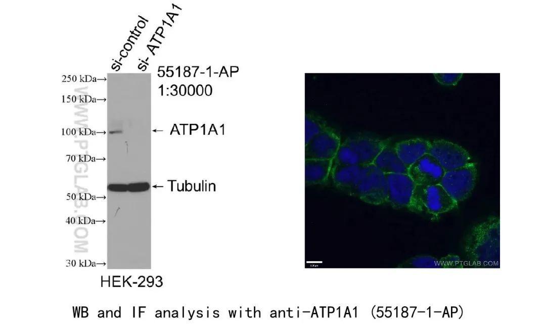 wb 常用内参是什么？ - 知乎
