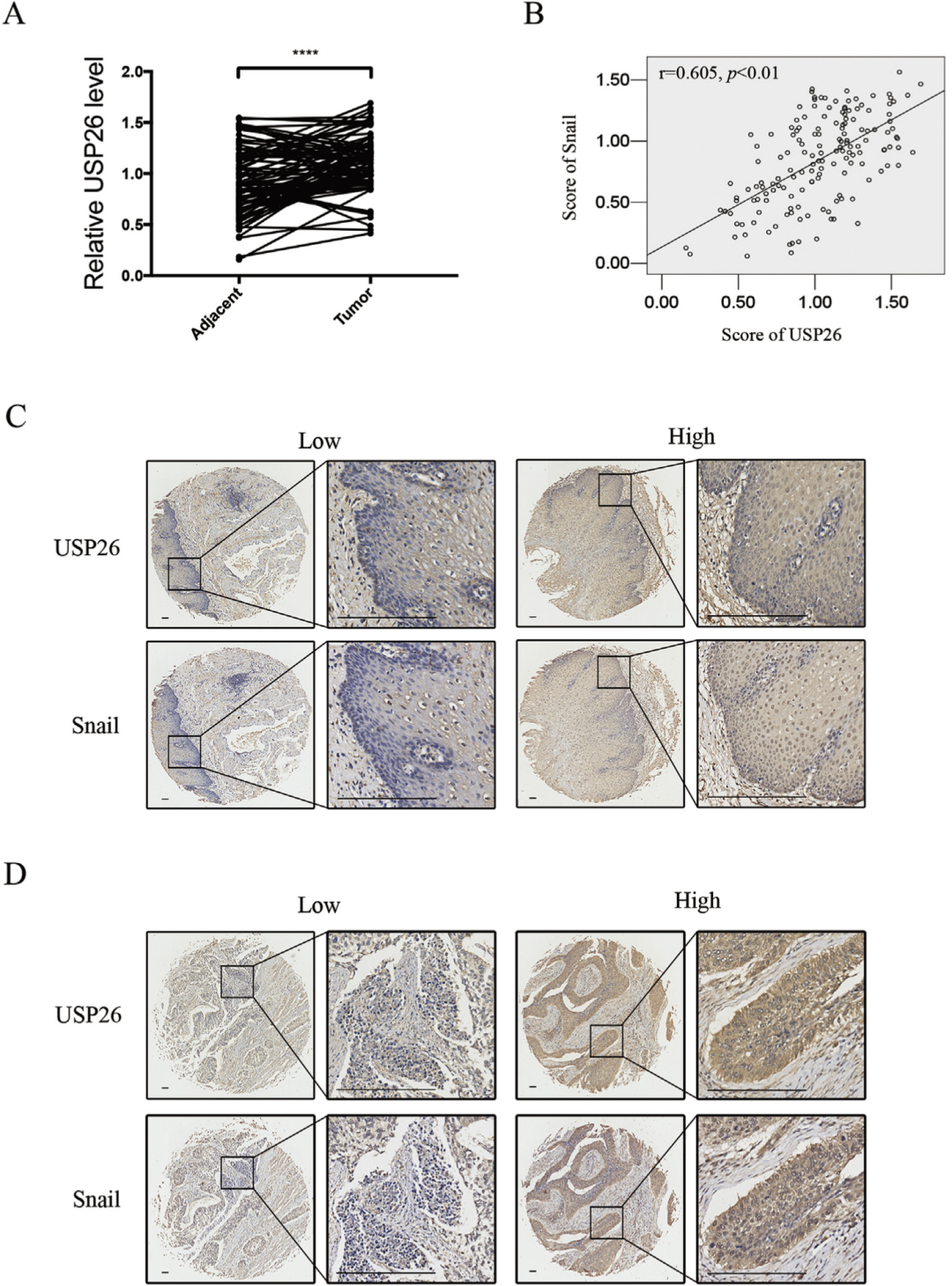 USP26通过稳定Snail促进食管鳞状细胞癌转移 - 知乎