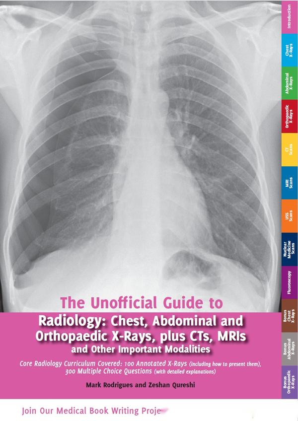 The Unofficial Guide to Radiology - 知乎