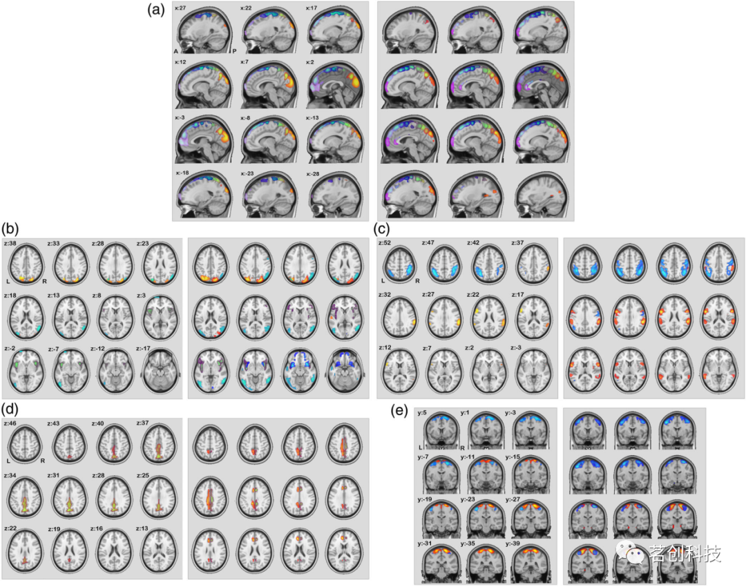 Hum Brain Mapp | 联合连接矩阵独立成分分析：结构和功能连接的自动链接 - 知乎